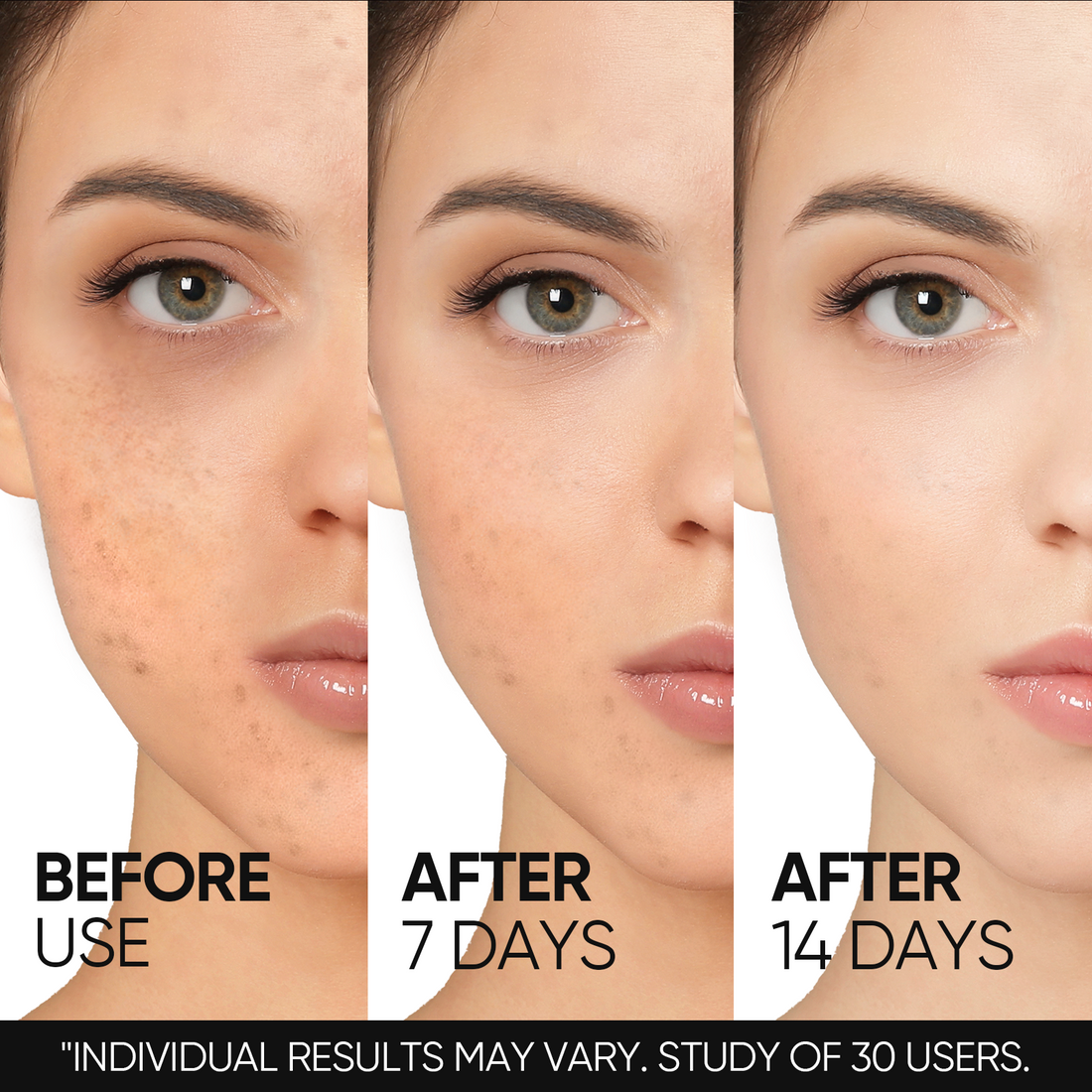 SKINTIFIC 10% Niacinamide Brightening Serum Whitening Glowing Skin Ski